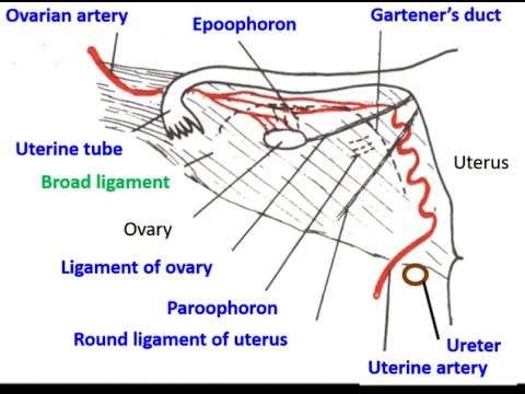 The vestigial structures found in the Broad ligament of the female genitalia; Paroophoron Epoophoron