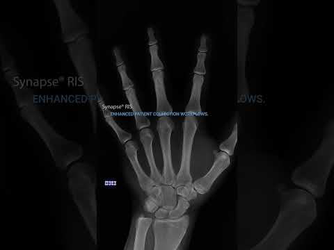 Synapse® RIS: More Streamlined Processes for Enhanced Efficiency and Modern Patient Experiences