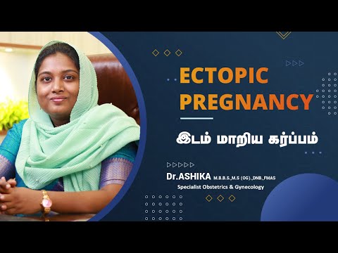 Ectopic Pregnancy in Tamil | கருக்குழாயில் குழந்தை தங்குவதால் ஏற்படும் ஆபத்து ! | Dr. Ashika