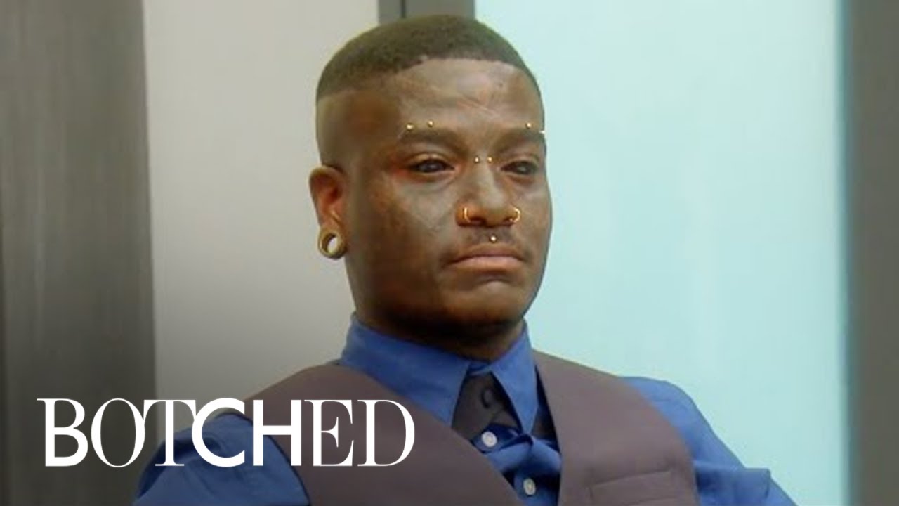 Body Mod Guy Wants to Remove Nipples and Belly Button?! | Botched | E!