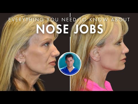 NOSE JOB SURGERY EXPLAINED: WHAT YOU NEED TO KNOW ABOUT RHINOPLASTY AND REVISION RHINOPLASTY
