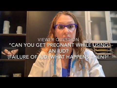 25) “Can You Get Pregnant While Using an IUD? (IUD Failure) What Happens Then? (Viewer Question)