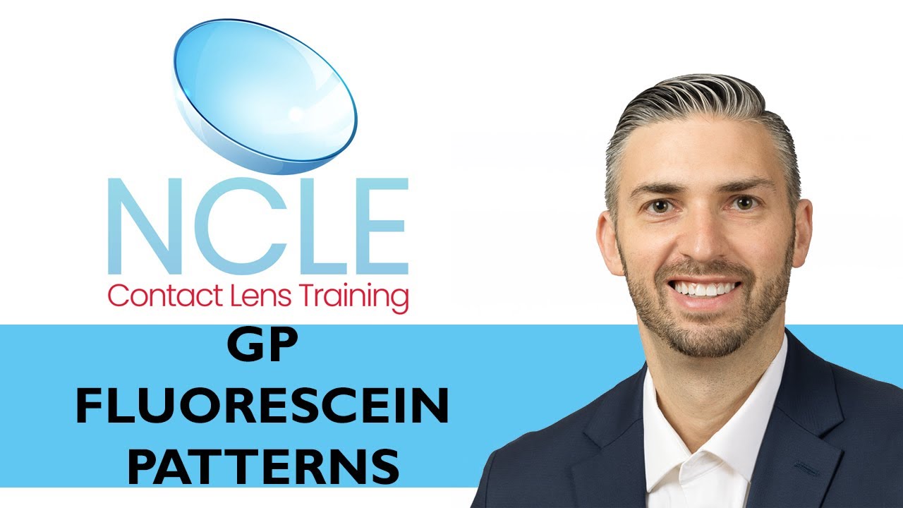 NCLE GP FLUORESCEIN PATTERNS