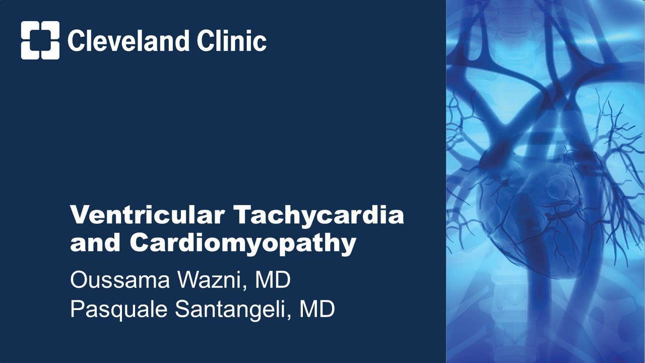 Ventricular Tachycardia and Cardiomyopathy