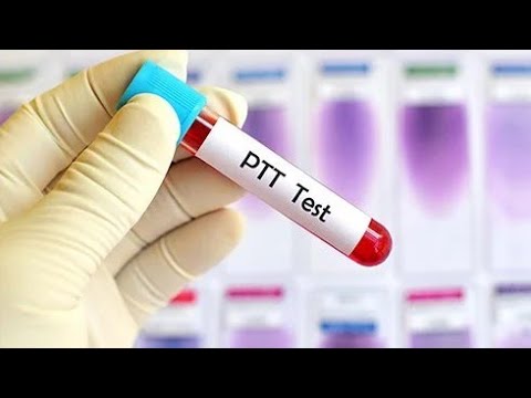 Hematology - Partial Thromboplastin Time (PTT)
