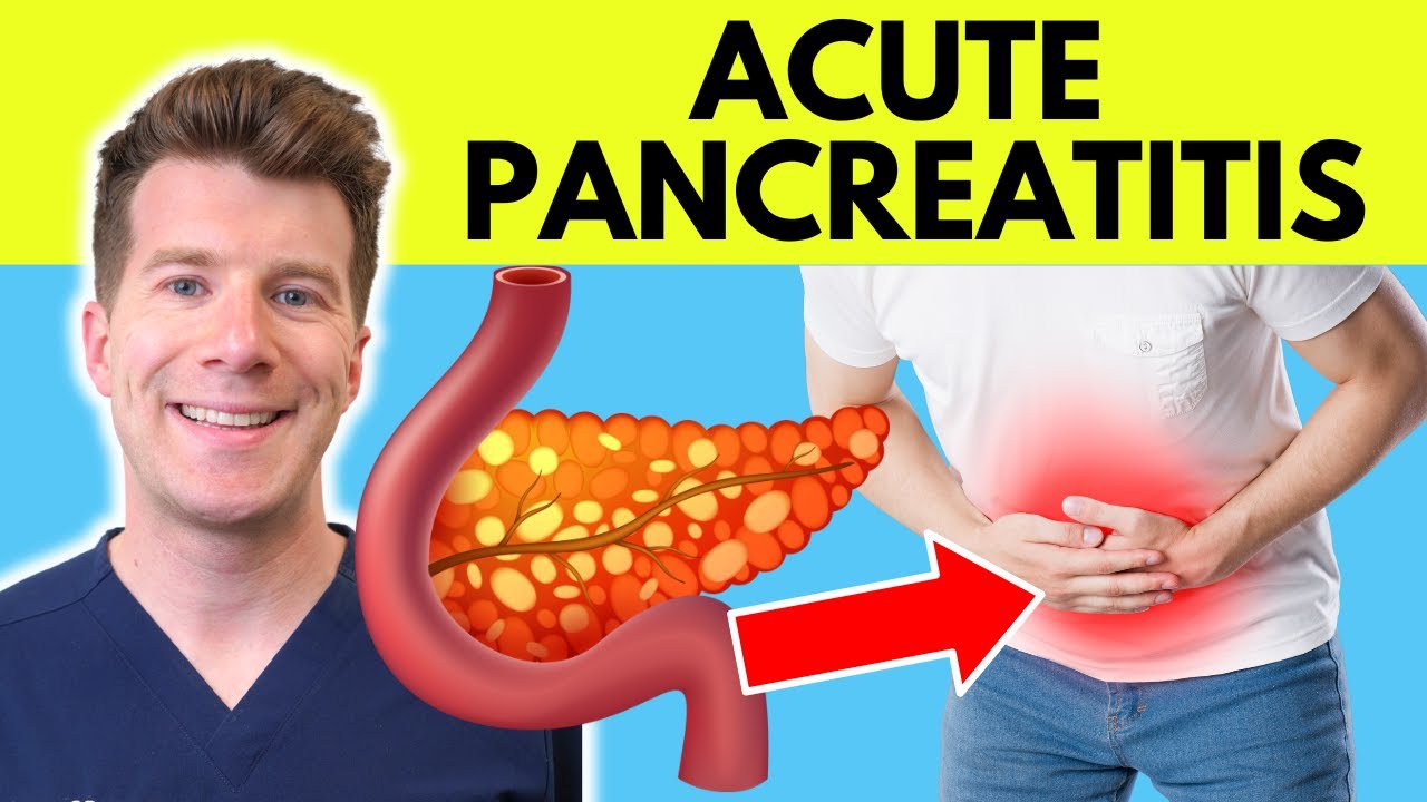 Doctor explains Acute Pancreatitis | Causes, Symptoms, Treatment