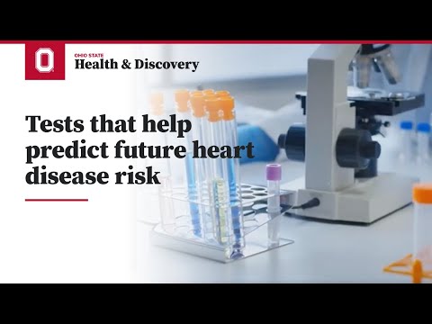 Tests that help predict future heart disease risk | Ohio State Medical Center