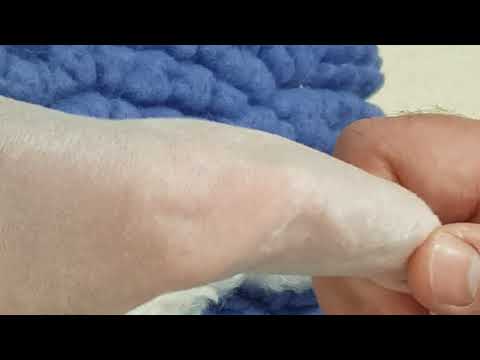Luxating Patella in the Dog