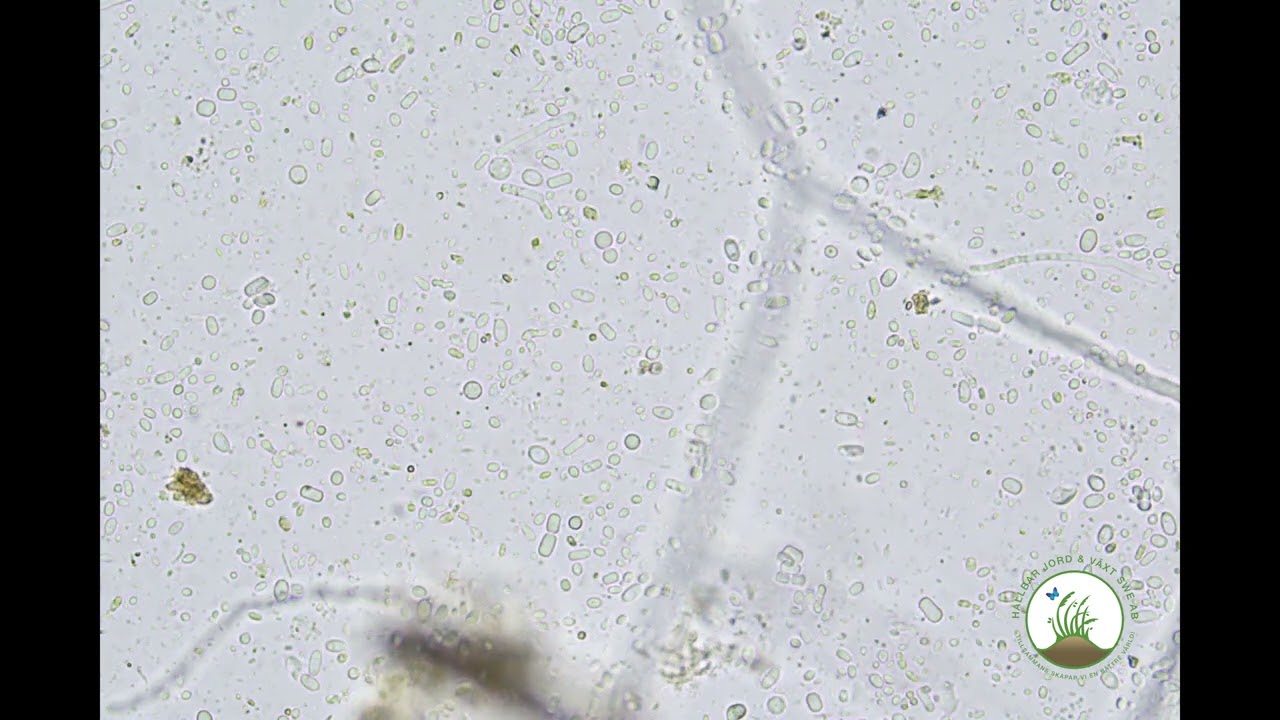 Oomycete under a microscope