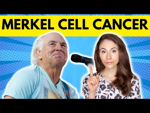 Merkel Cell SKIN CANCER EARLY SIGNS NOT TO MISS