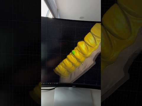 Perfect Occlusion in Digital Smile Design | Bexocad