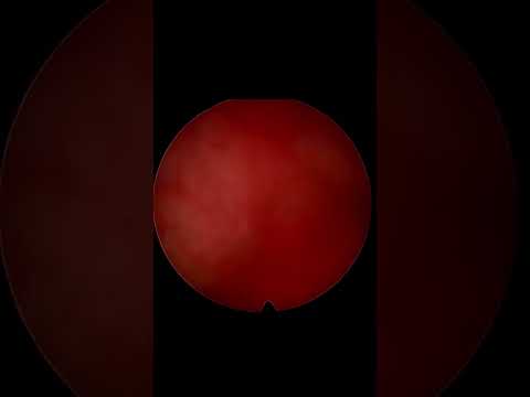 what does a woman's period look like from inside the uterus?