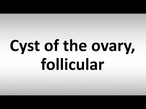 How to Pronounce Cyst of the ovary, follicular