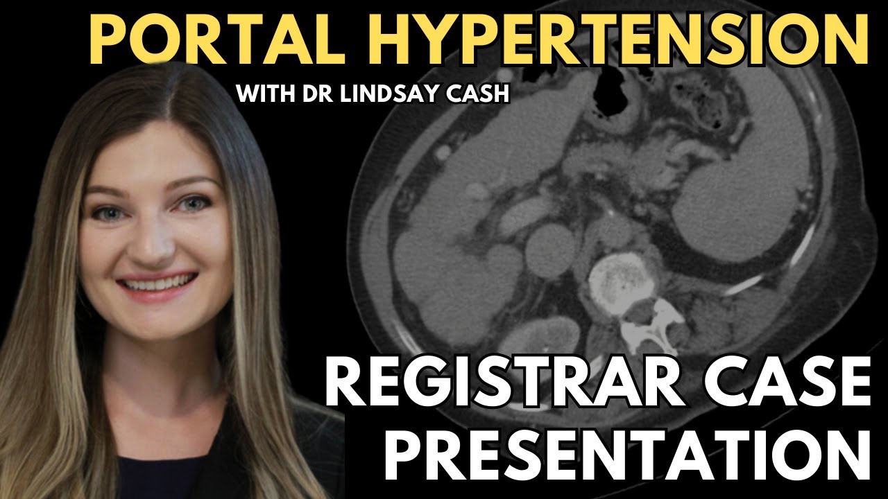 Cirrhosis and Portal Hypertension | CT Abdomen | Registrar Sessions