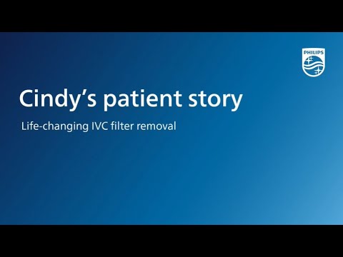 Life-changing IVC filter removal - Cindy's patient story
