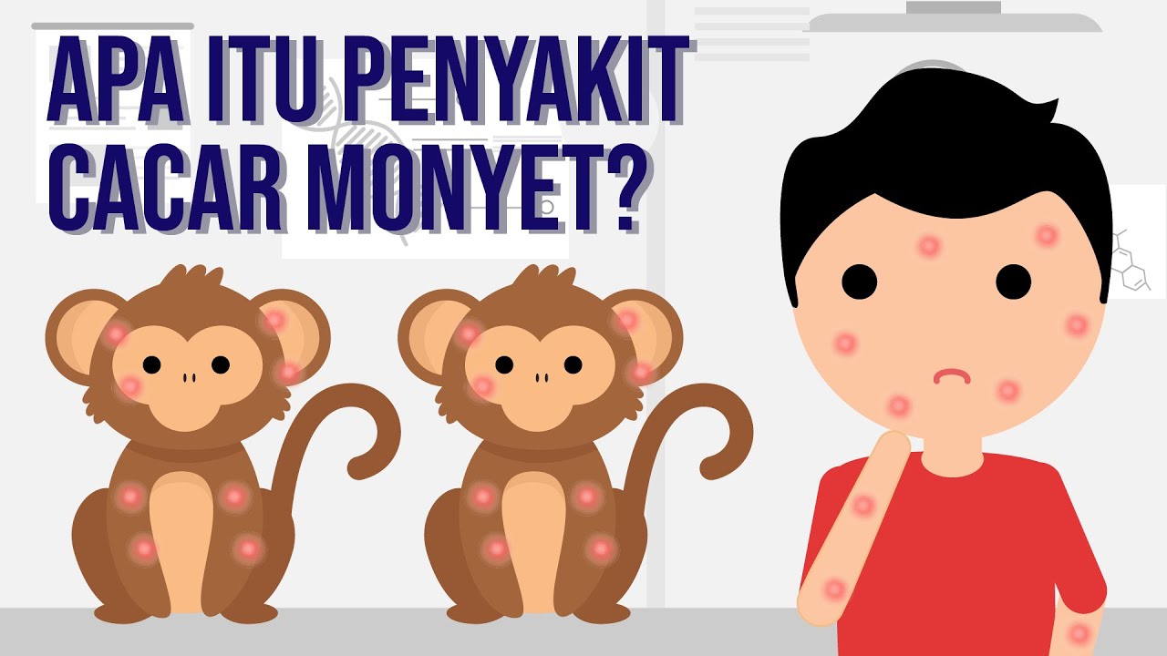 What is Monkeypox?