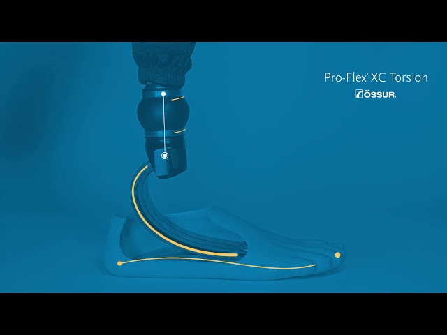 Prosthetics Foot - Sports Prosthesis leg Manufacturer from Bengaluru