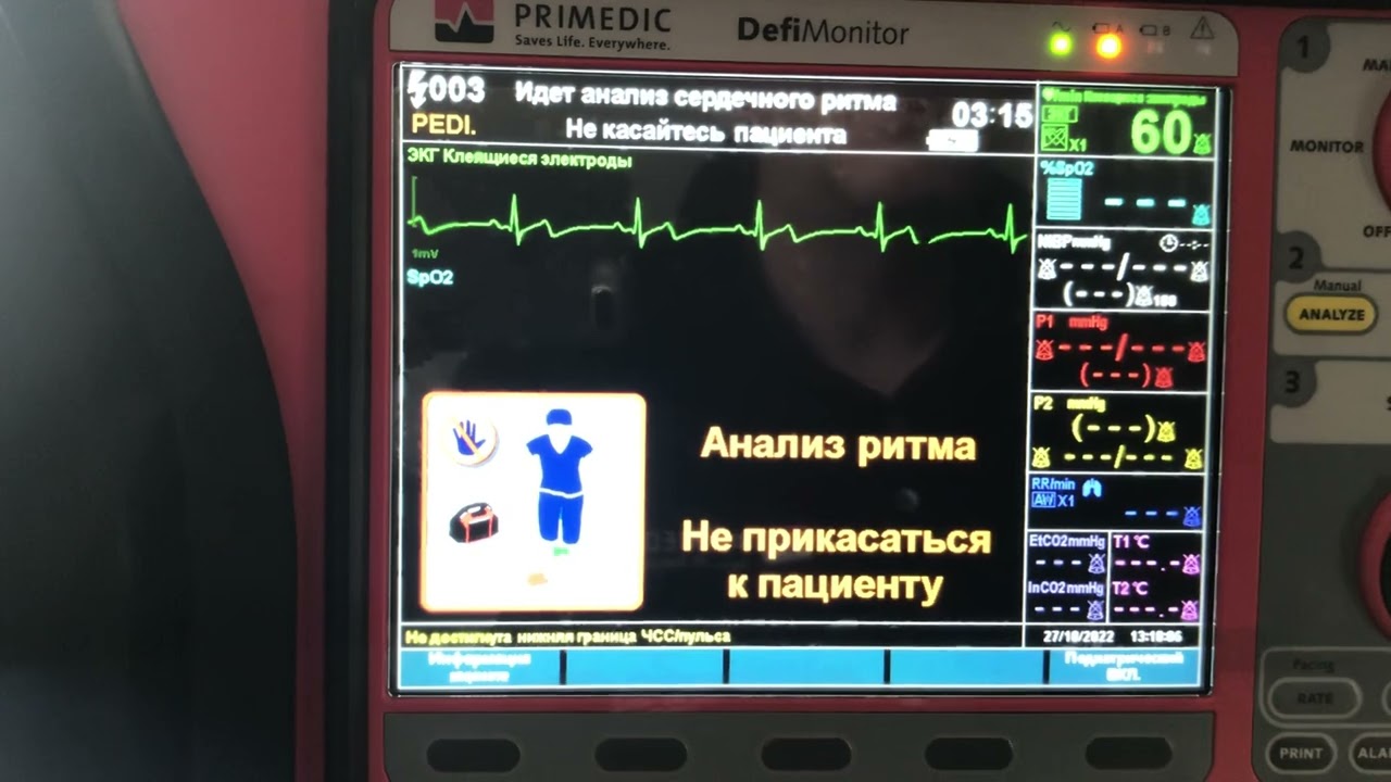 New METRAX PRIMEDIC Defi-Monitor EVO IV for Sale - $7609 item# 1969320 ...