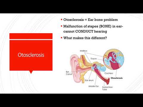 Med-Surg: Understanding Ear and Eye: The Basics