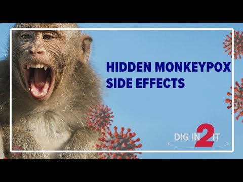 What is monkeypox and what does it look like?