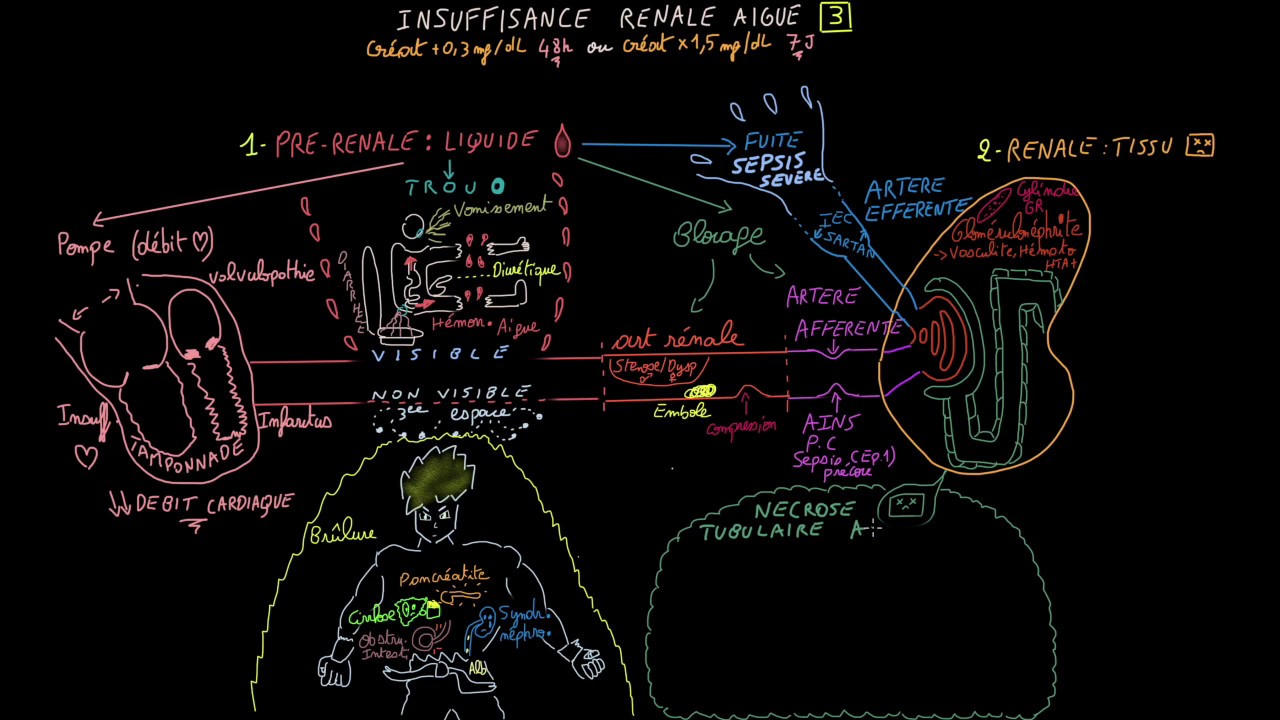 Acute Renal Failure - Doctor Synapse