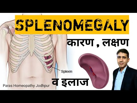Splenomegaly | तिल्ली बढ़ना | Enlarged Spleen in Hindi | Spleen Enlargement Homeopathic Treatment