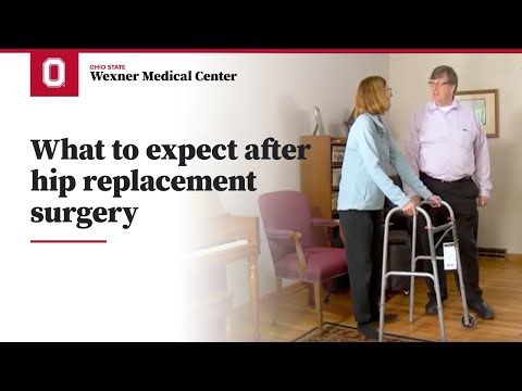 What to expect after hip replacement surgery | Ohio State Medical Center