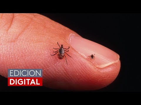 Síntomas de la picadura de la garrapata estrella solitaria, la cual provoca alergia a la carne roja