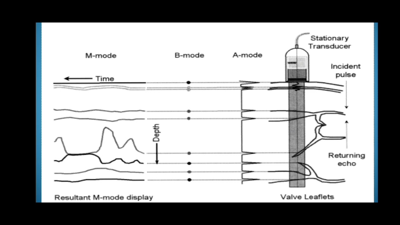 Understanding Ultrasound Technology: Components and Functionality ...