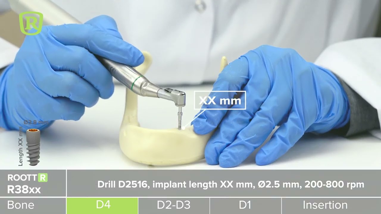Drilling protocol R38XX