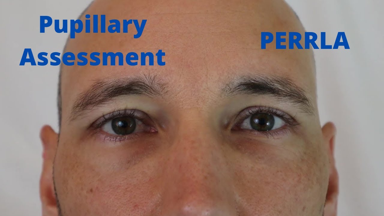 Pupillary Assessment (PERRLA)