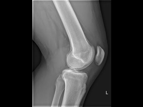 Radiographic Positioning of Lower Leg and Knee (A)