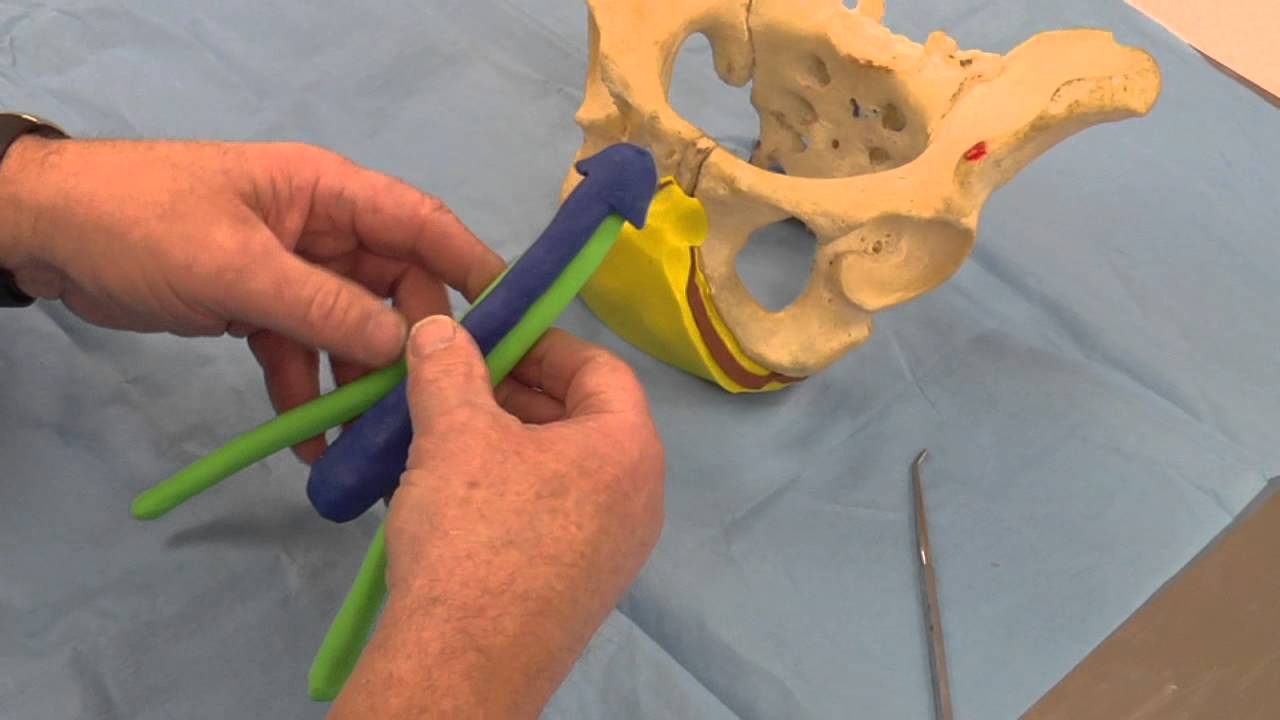 Let's build a perineum