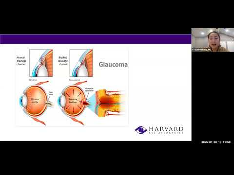 Glaucoma Basics: Risk Factors, Diagnosis, and Treatment Options