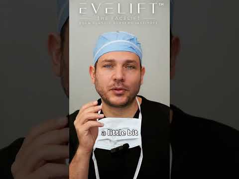EVE Lift™ with Extended Necklift Before and After | Eden Plastic Surgery: Dr. Ali Charafeddine, MD