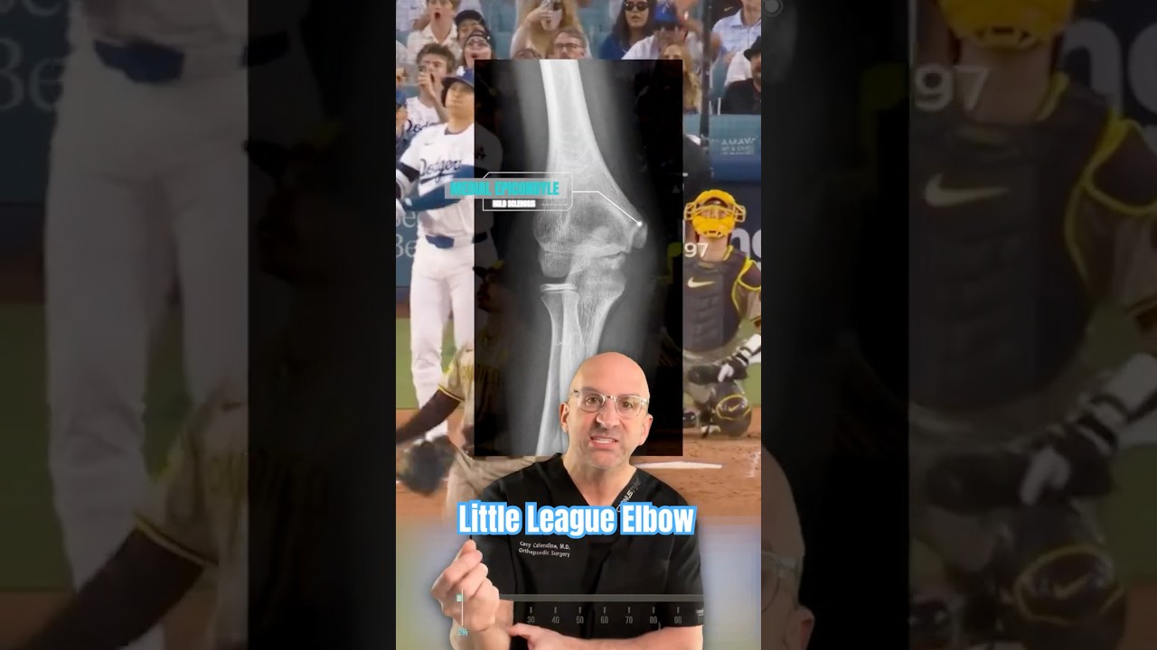 Little Leaguer’s Elbow ⚾️ Big League Elbow Pain #shorts