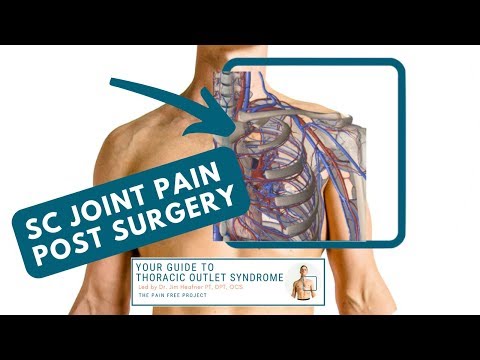 SC Joint Pain Post Surgery