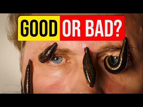 The Interesting History of Leeches