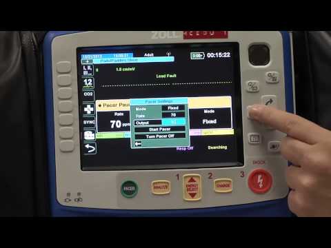 Transcutaneous Pacing Demonstration