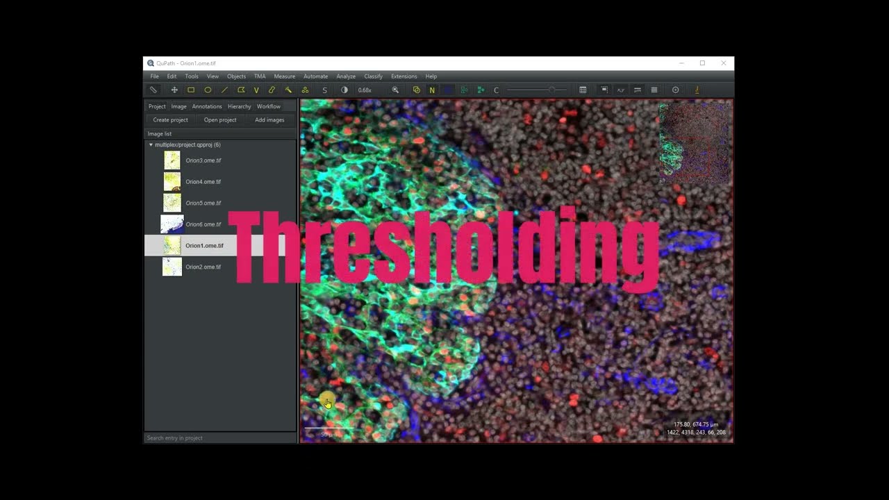 QuPath: Thresholding