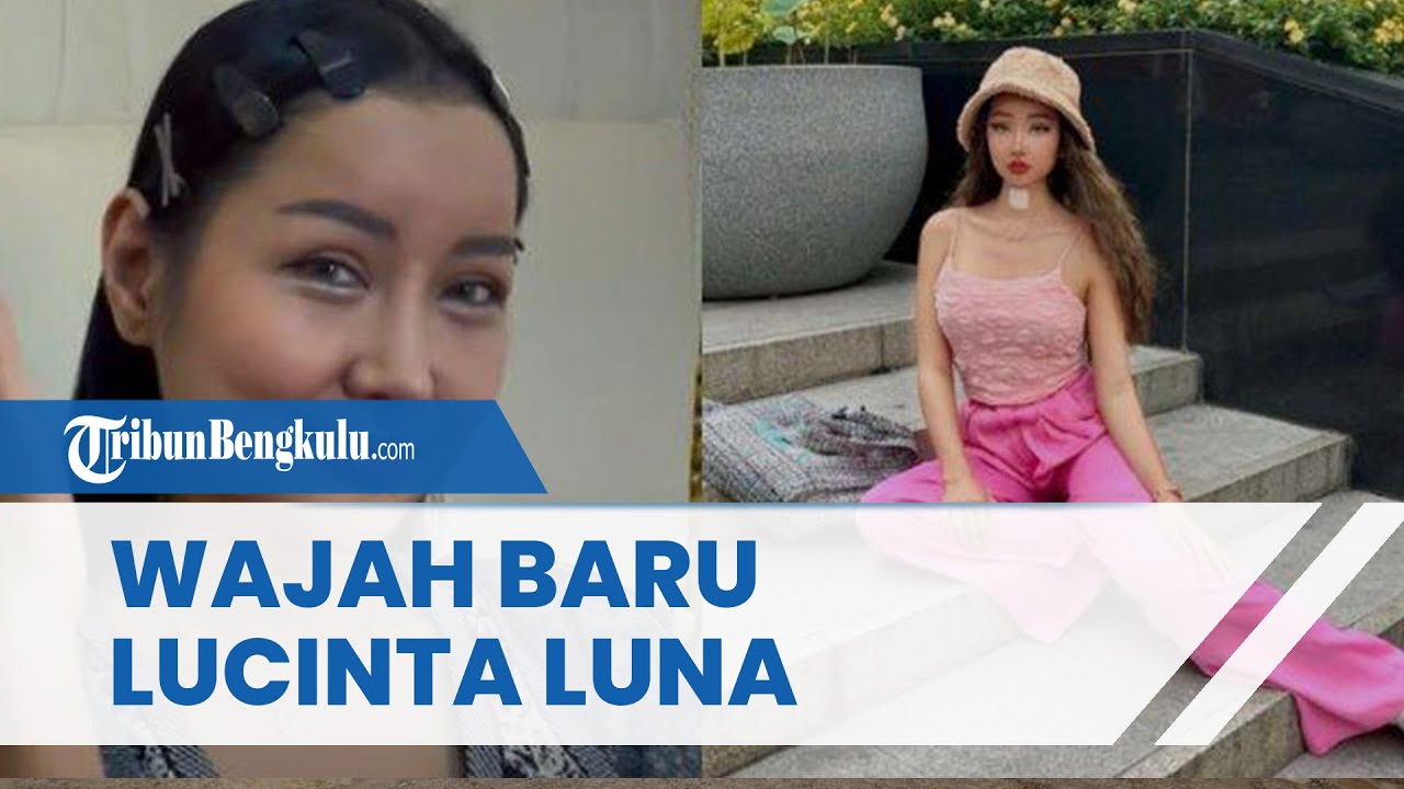 Penampakan Wajah Lucinta Luna Hasil Operasi di Korea Selatan, Mengaku ...