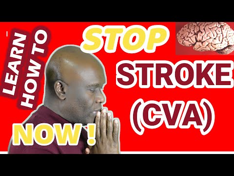 Are You Having A Stroke (CVA)