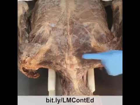Part 1. Trapezius  NECK, MIDDLE BACK OR SHOULDER PAIN? IMPINGEMENT SYNDROME? HEADACHES? .  TRAPEZIUS