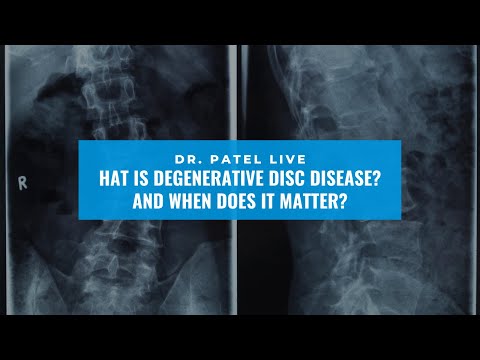 Dr. Patel LIVE: What is degenerative disc disease? And when does it matter?