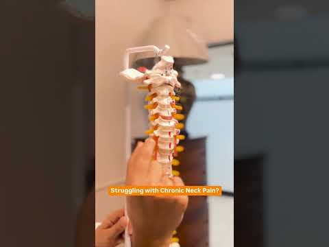 Understanding Cervical Radiculopathy.