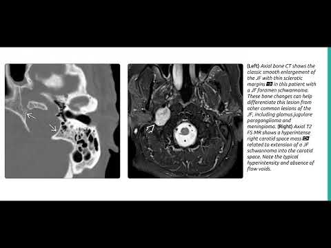 Head and neck radiology diagnostic imaging series images only(2)