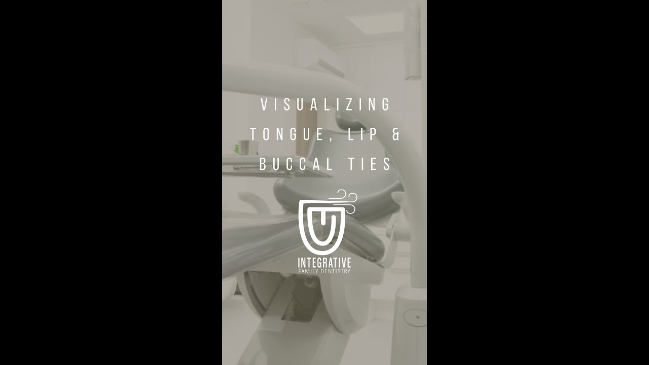 Visualizing Tongue, Lip and Buccal Ties