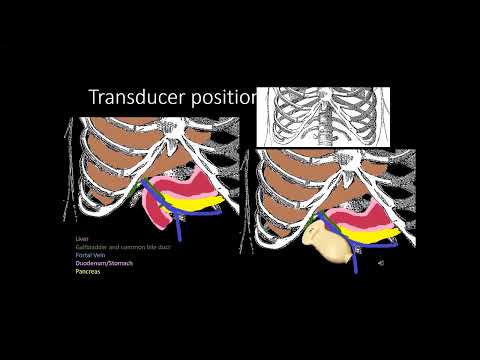 Gallbladder PoCUS Exam Protocol