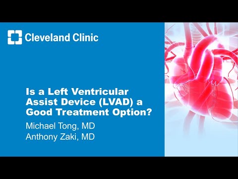 Is a Left Ventricular Assist Device (LVAD) a Good Treatment Option?