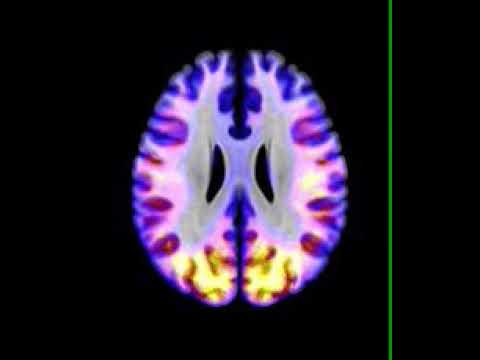 Research | Coma Neuroscience Lab